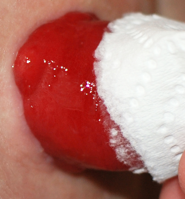 Using Duoderm to protect peristomal skin – Ostomy Outdoors